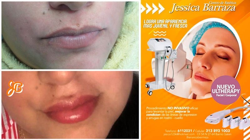 Centro de Estética Jessica Barraza | Barrancabermeja